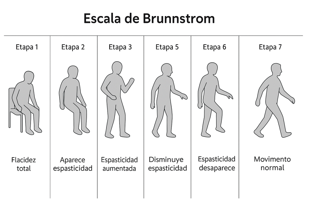 La Escala de Brunnstrom: Rehabilitación Neurológica - NeuroAiD™