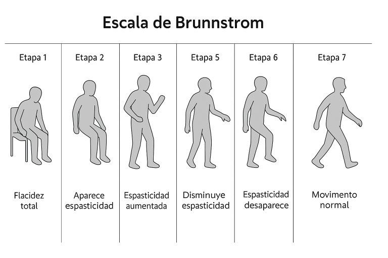 La Escala de Brunnstrom: Rehabilitación Neurológica - NeuroAiD™