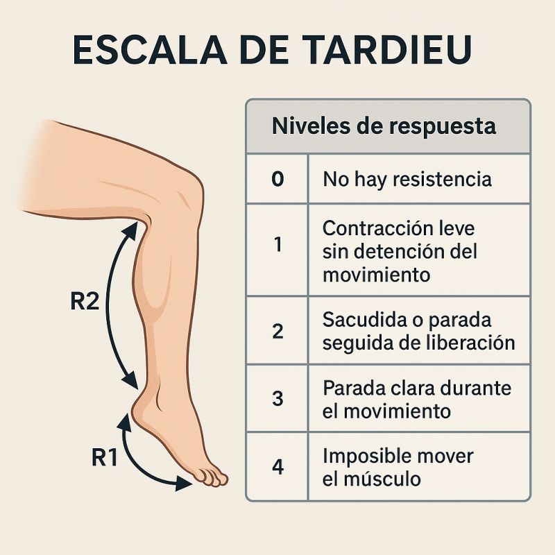 La escala de Tardieu: evaluación de la espasticidad neurológica - NeuroAiD™