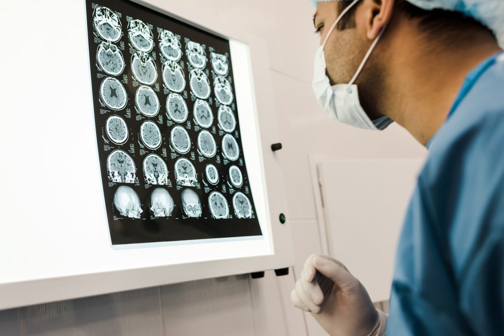 Derrame cerebral por golpe: consecuencias - NeuroAiD™