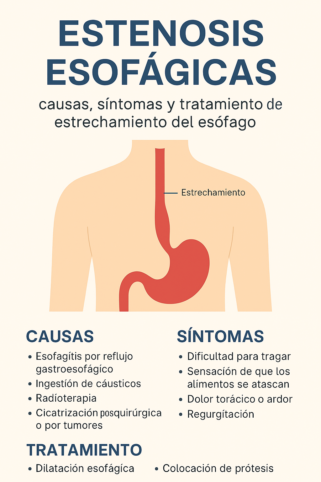 Estenosis esofágicas: qué son, cómo se diagnostican y cómo se tratan ...