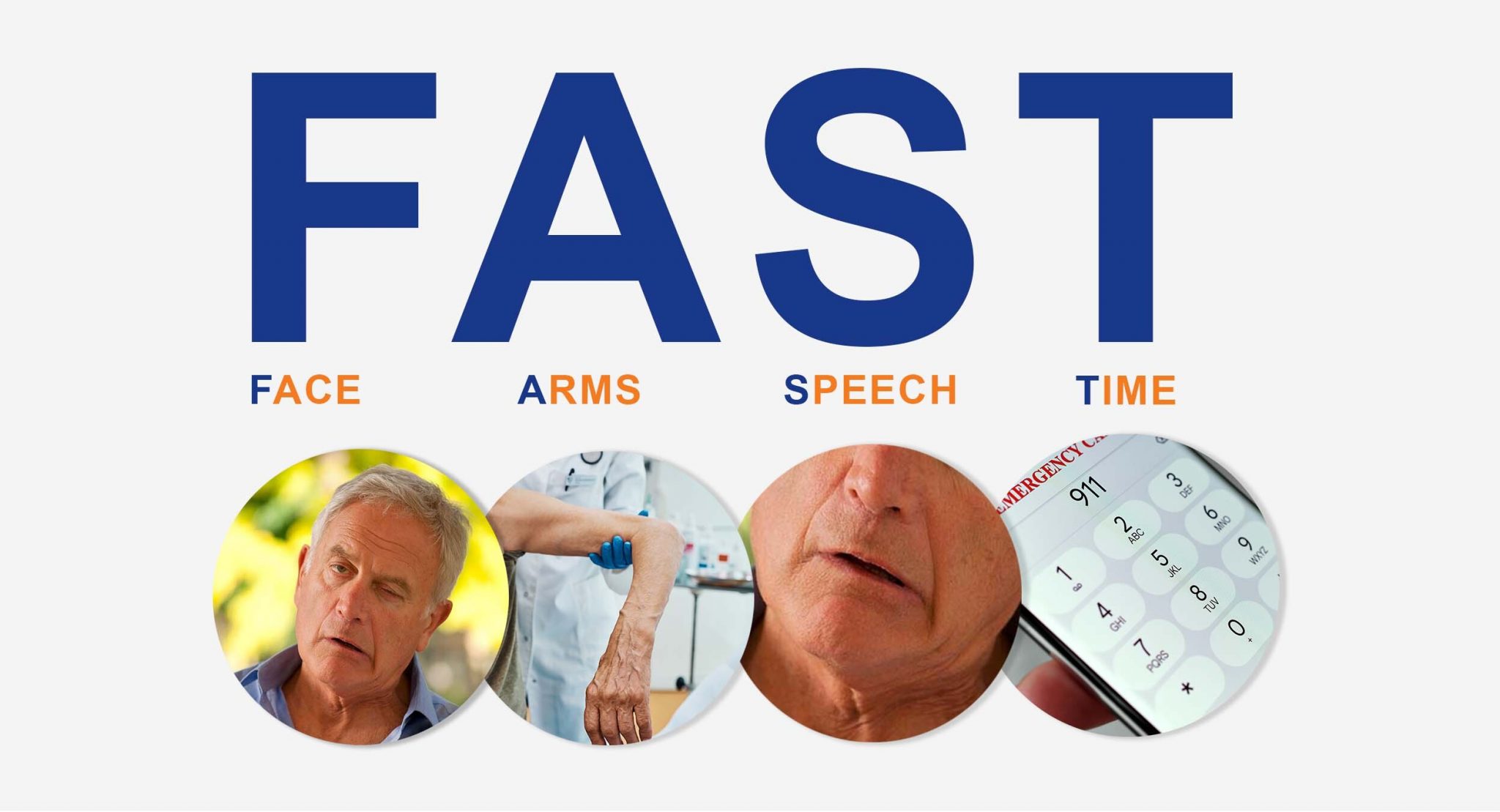 Síntomas de isquemia cerebral