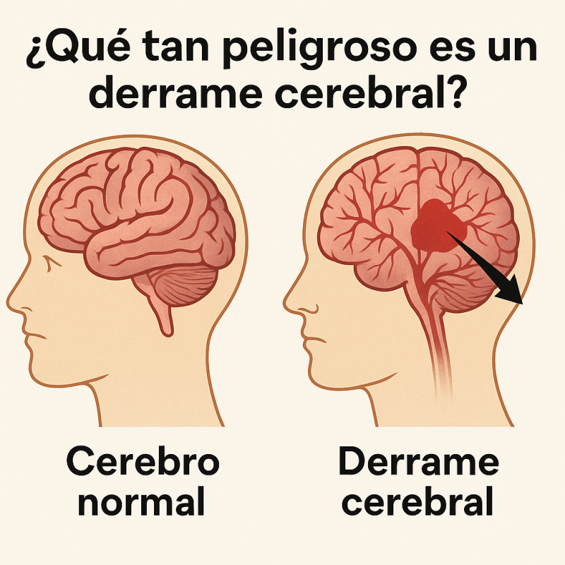 Qué tan peligroso es un derrame cerebral: comprensión y riesgos - NeuroAiD™