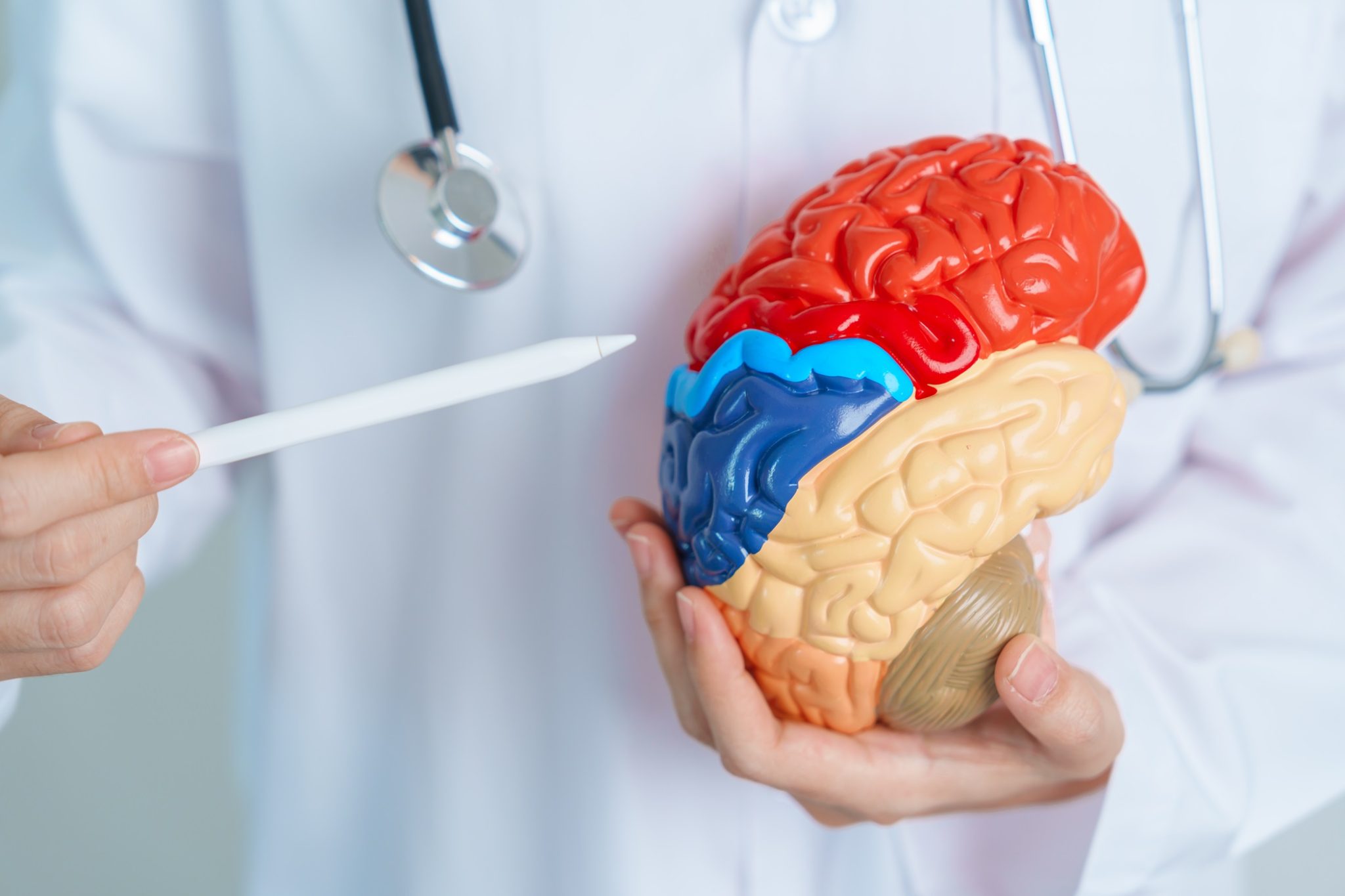 ICD-10 Stroke: Classification and Treatment of Cerebrovascular Accident - NeuroAiD™