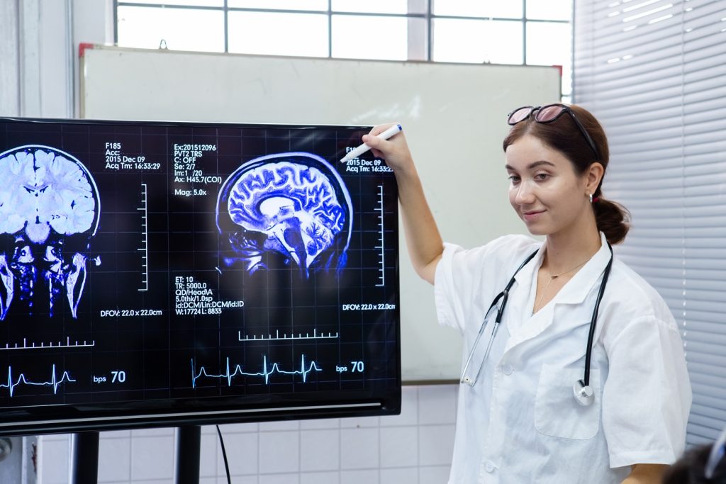 Cerebral edema: causes, implications, and management in stroke - NeuroAiD™
