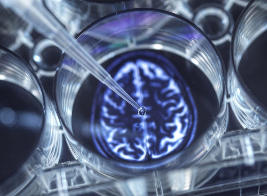 Neuroprotection: definition, mechanisms, and therapeutic strategies ...