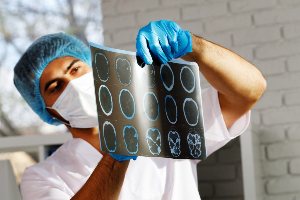 Endoscopic ventriculostomy and advanced treatment for hydrocephalus ...