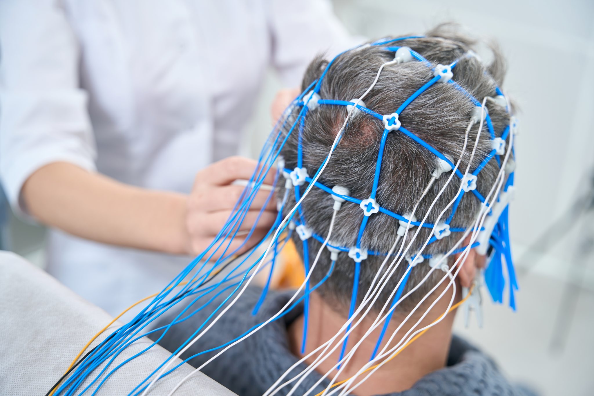 Tonic-Clonic Seizures: Characteristics, Diagnosis, and Treatment ...