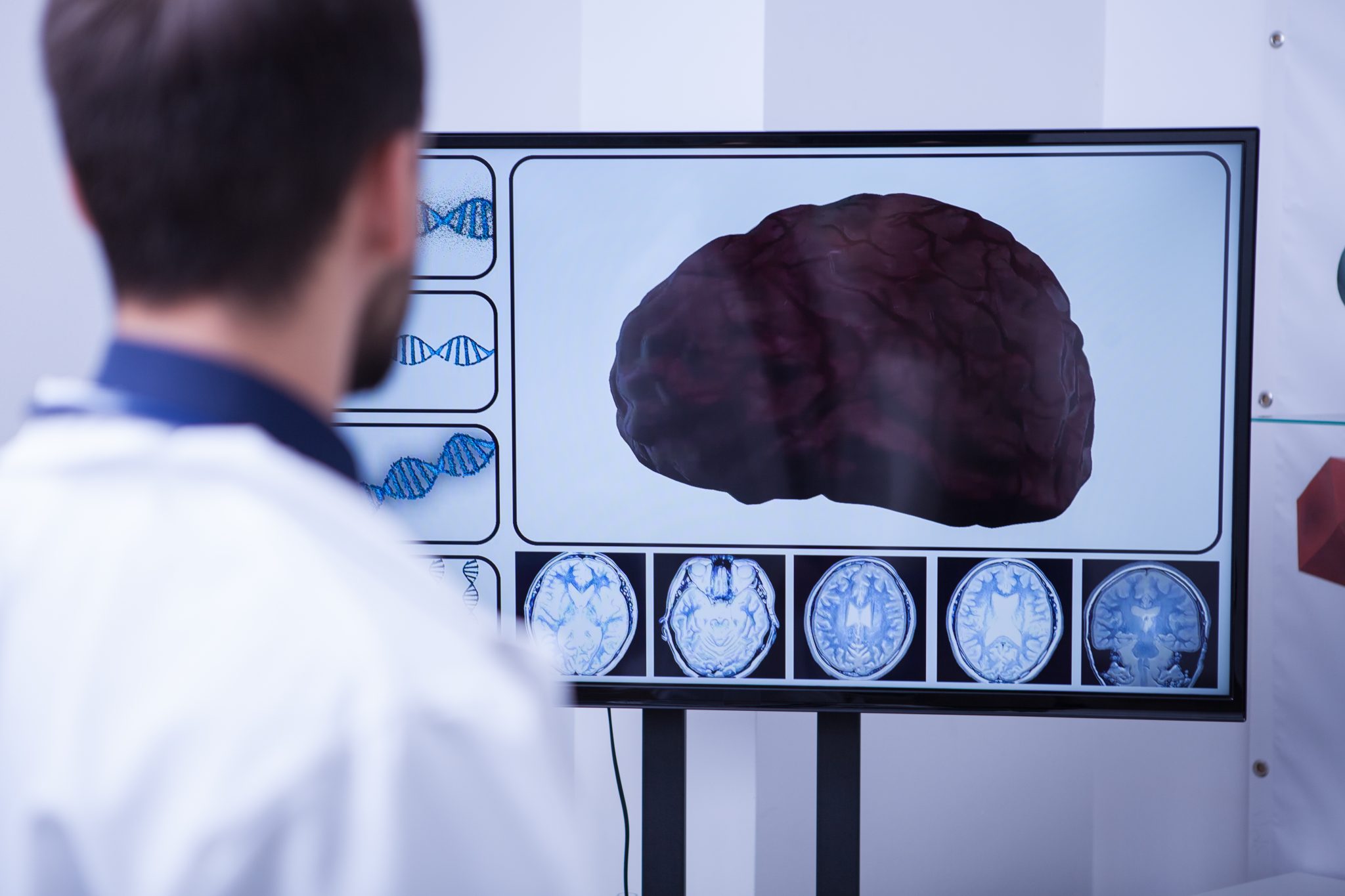 Decussation of brain fibers: the anatomy of the brain - NeuroAiD™