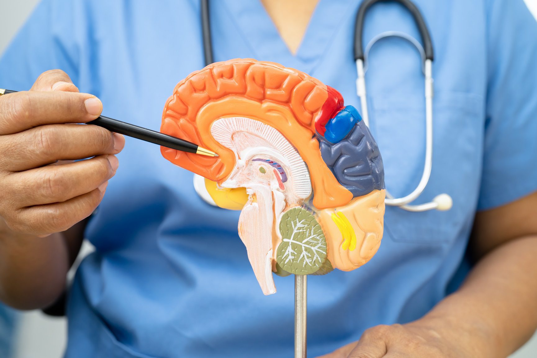 ¿Qué es un Ictus? Causas, Síntomas y Tratamientos - NeuroAiD™